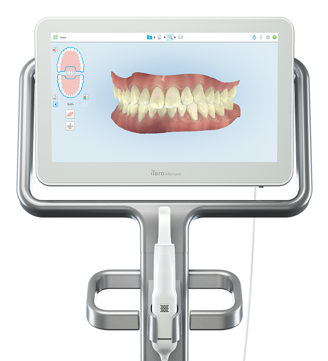 ITero™ Digital Scanning Houston TX | The Dentists at Houston Westchase